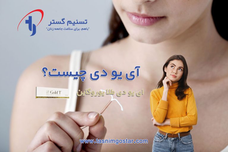 ای‌ یو‌ دی طلا یوروگاین اسپانیا (Eurogine Gold T IUD ) - تسنیم گستر